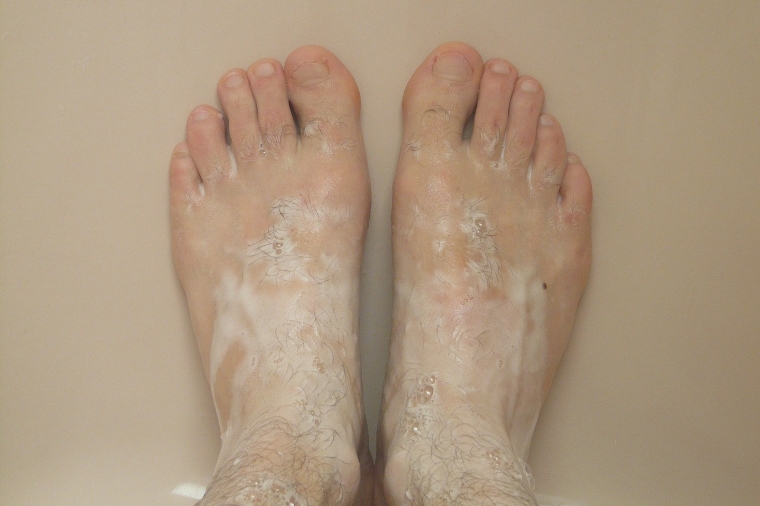 Diabetic Foot Care | Bentley Podiatry